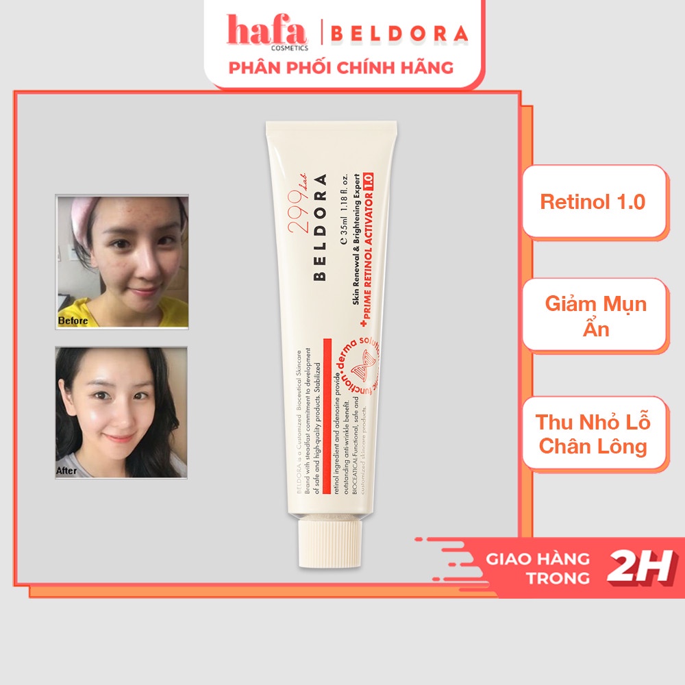 Kem Dưỡng Retinol 1.0 Giảm Mụn Ẩn, Tái Sinh Làn Da BELDORA 299 Prime ...