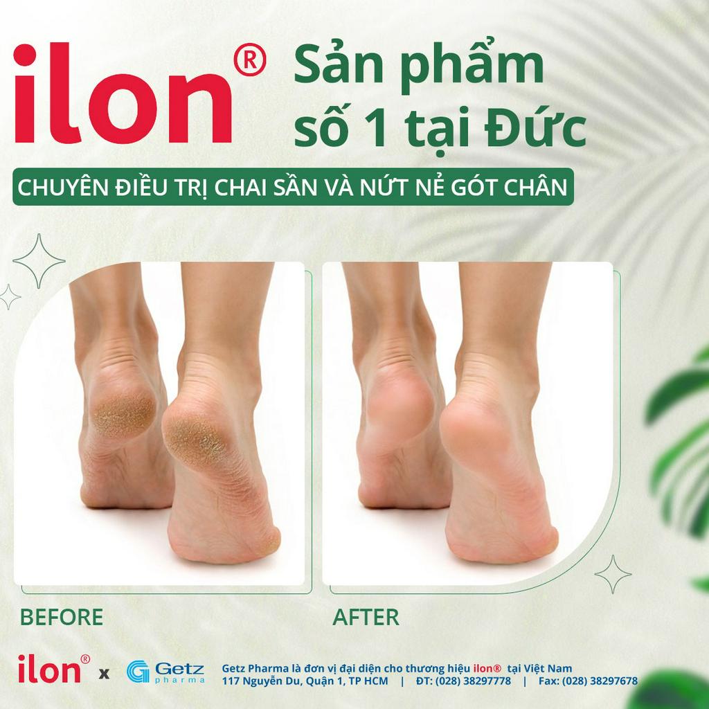 ilon Việt Nam, Cửa hàng trực tuyến | Shopee Việt Nam