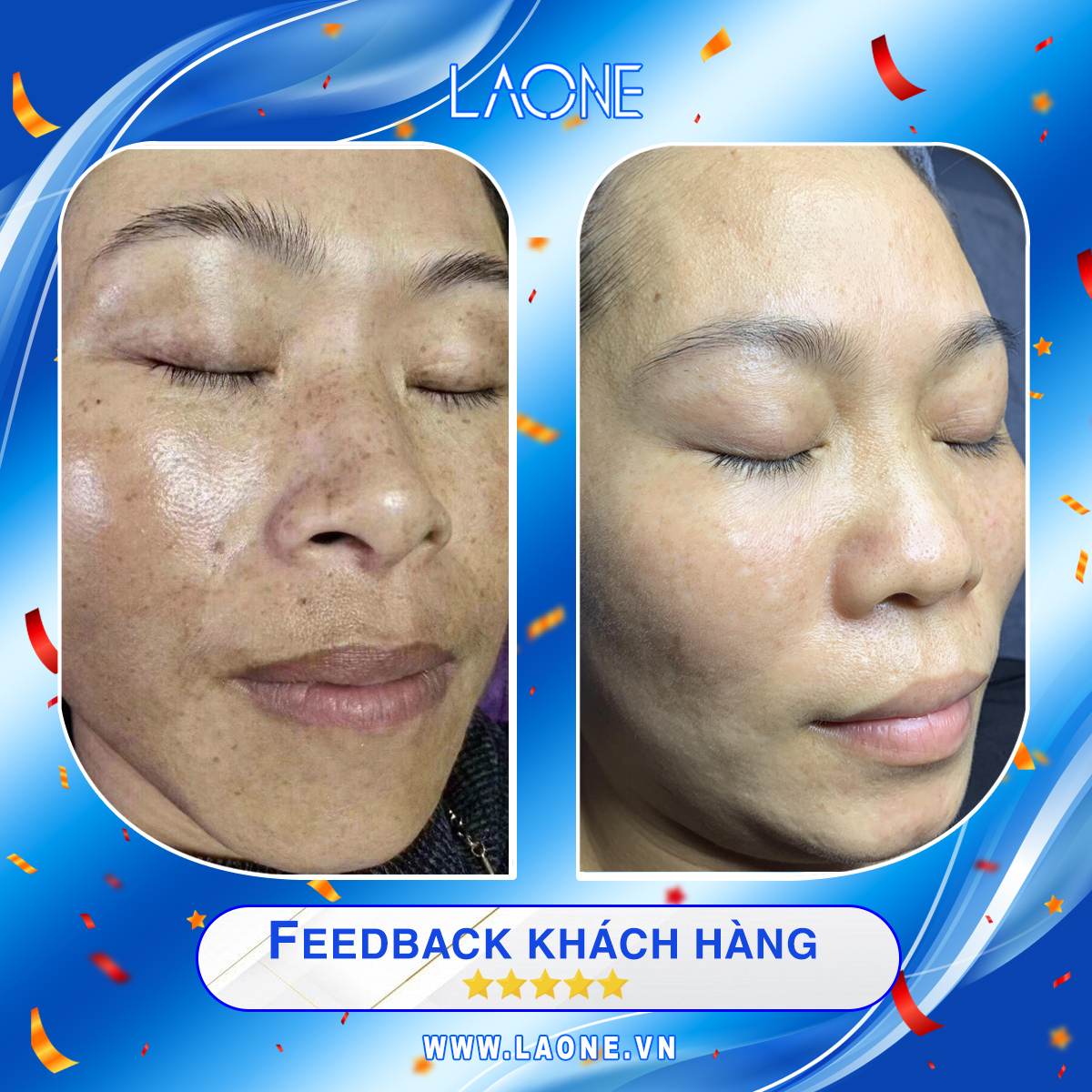 Laone Official Store - Shopee Mall Online | Shopee Việt Nam