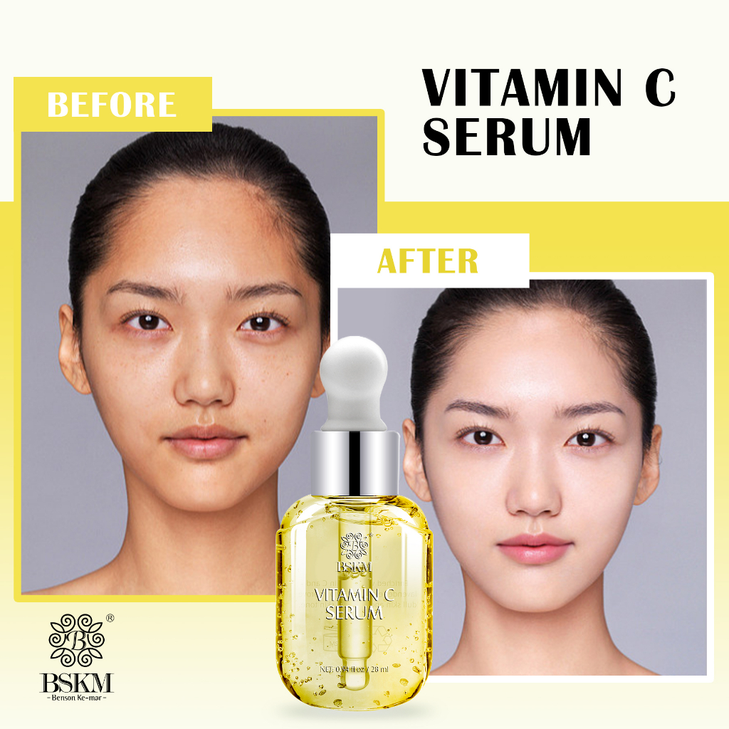 BSKM Serum Vitamin C Niacinamide Tự Nhiên Dưỡng Trắng Sáng Da Mặt Làm ...