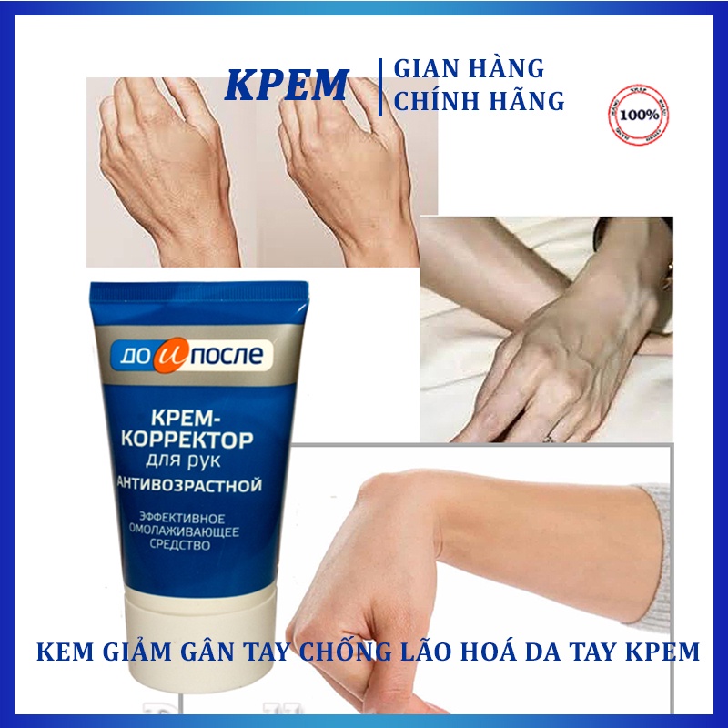 Mua Kem Giảm Gân Tay Chống Lão Hoá Da Tay Kpem Của Nga 100ml - Kem Trẻ ...
