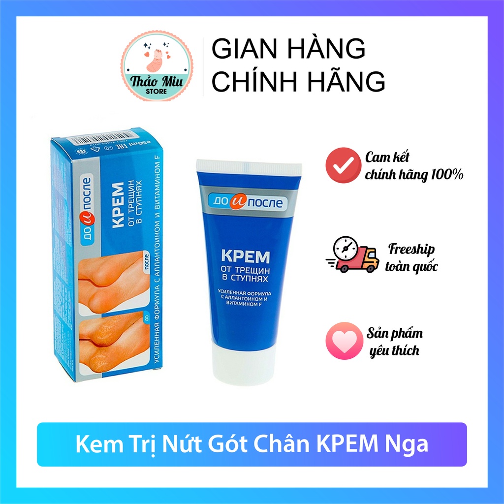 [Hàng Chính Hãng 100%] Kem Giảm nứt gót chân Kpem Apteka Chính Hãng Nga ...