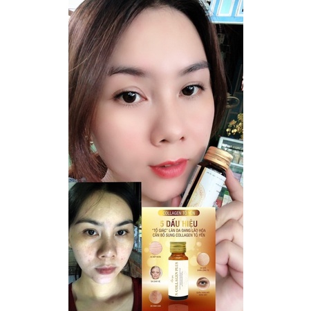 Mua Thực Phẩm Bổ Sung N’COLLAGEN PLUS Giúp Sáng Da Đẹp Da Giảm Nám Sạm Da Tăng Độ Đàn Hồi Cho Da ...