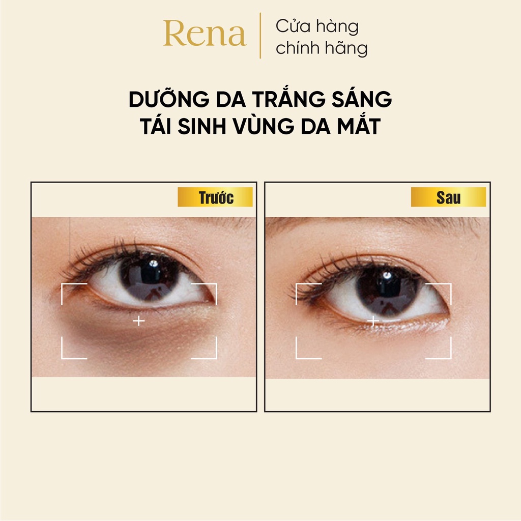 Mua Kem thâm mắt Rena Abera giúp giảm thâm mắt, bọng mắt, nếp nhăn vùng ...