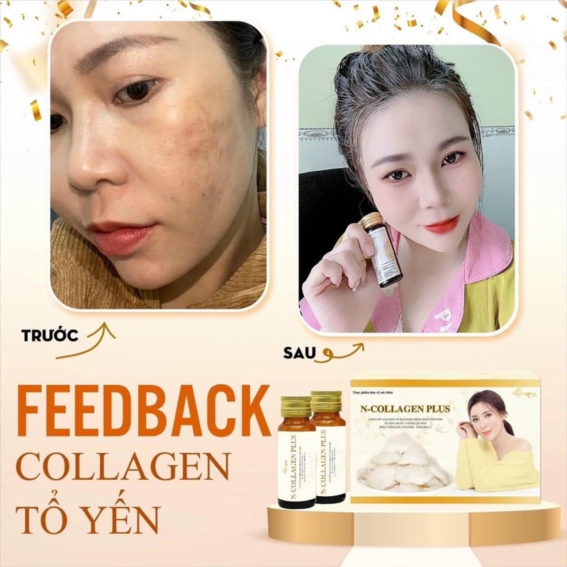 Mua Thực Phẩm Bổ Sung N’COLLAGEN PLUS Giúp Sáng Da Đẹp Da Giảm Nám Sạm Da Tăng Độ Đàn Hồi Cho Da ...