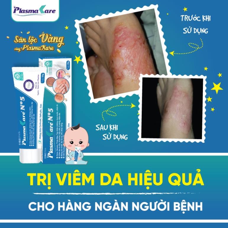 Mua Kem Bôi Da Nano Bạc PlasmaKare No5 Giảm Ngứa, Hỗ Trợ Kháng Khuẩn Da ...